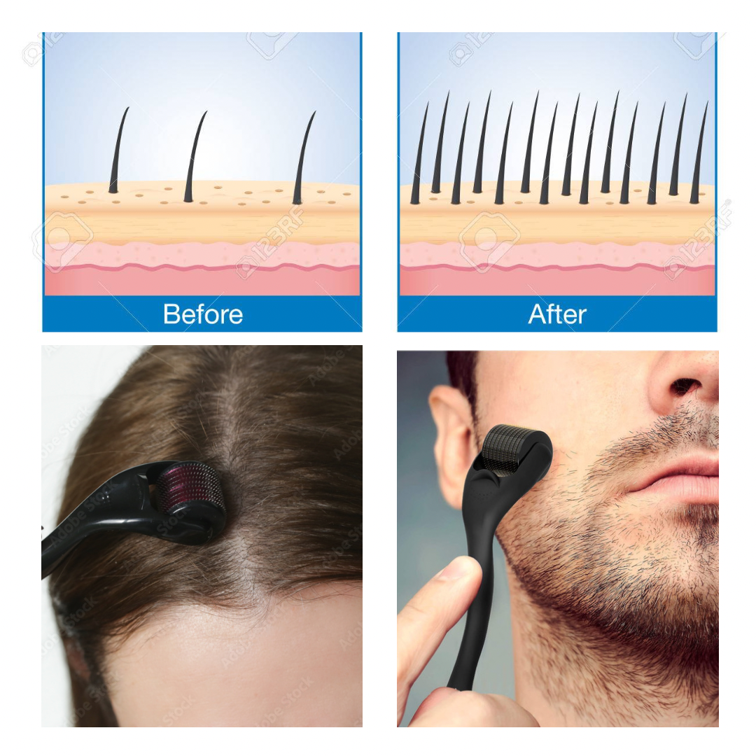 DERMAROLLER Cheveux et barbes 540-0,75mm – KOKOYA PARIS